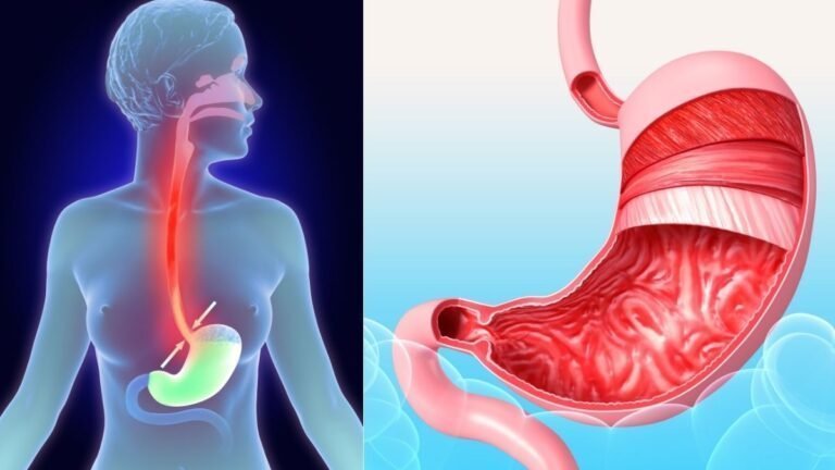 Nexium 40 Mg | Ne İlacıdır? | Yan Etkileri Neler? - Fitness Dergisi