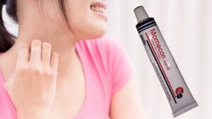 Momecon Krem Ne İçin Kullanılır? Yan Etkileri Neler? - Fitness Dergisi