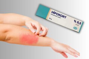 Hipokort Krem Ne İçin Kullanılır? Yan Etkileri Neler? – Fitness Dergisi